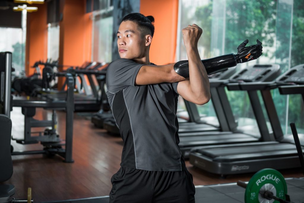 Vulcan Augmetics wants to make bionic hands affordable