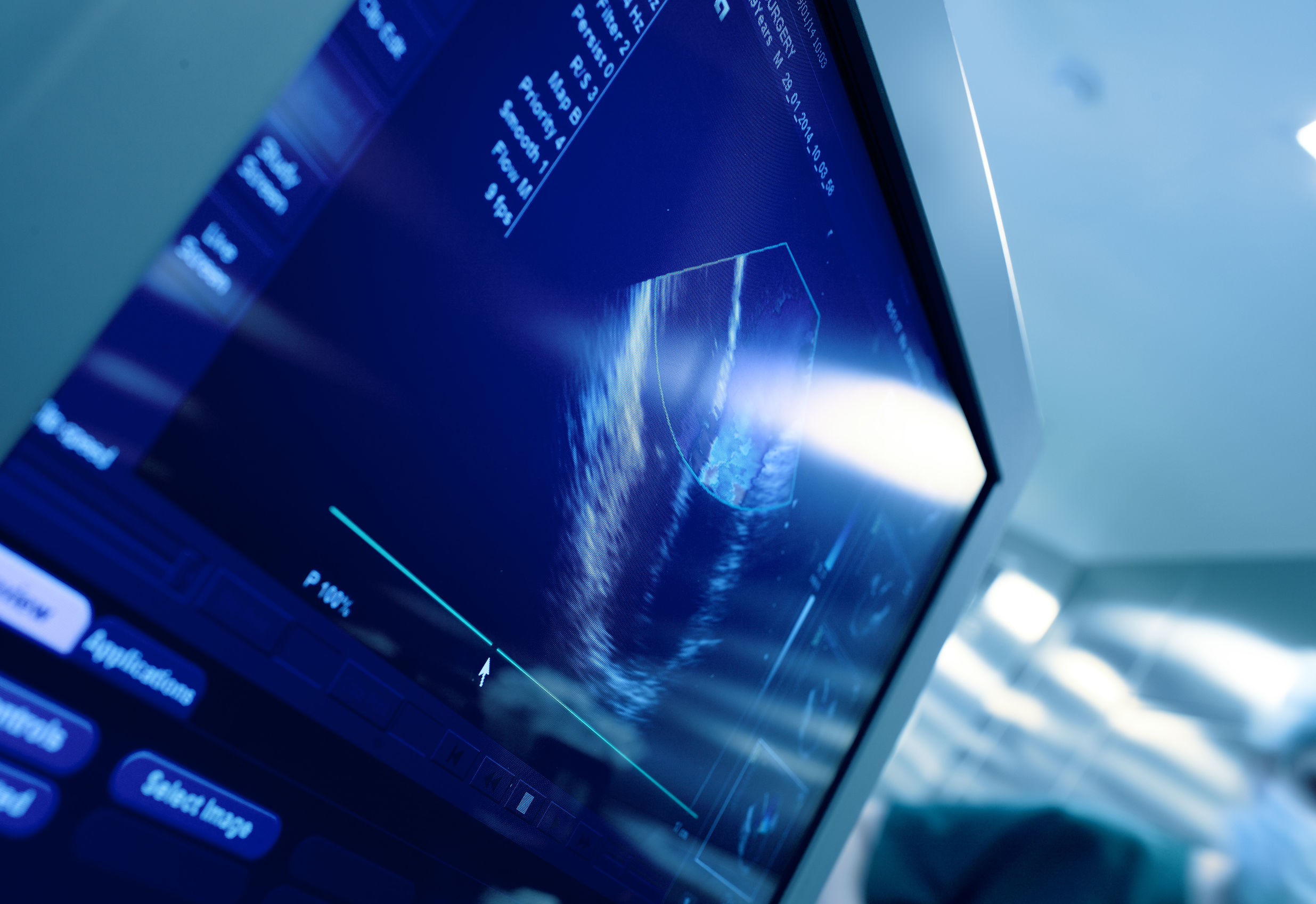 Eko.ai raises $4m from Sequoia India, EDBI, others