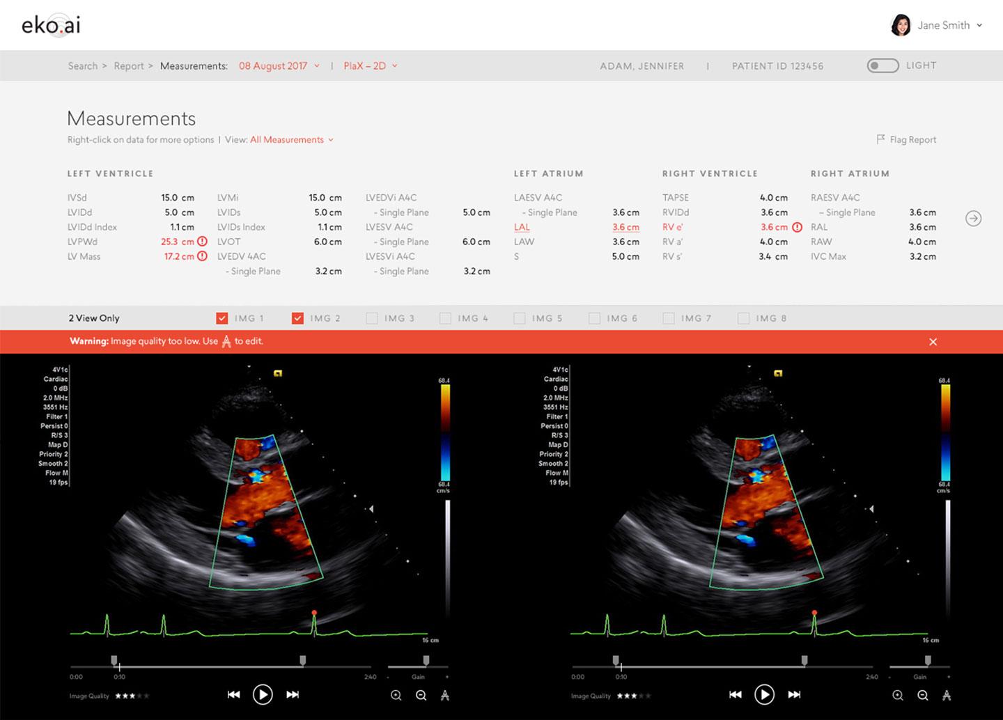 Eko.ai raises $4m from Sequoia India, EDBI, others